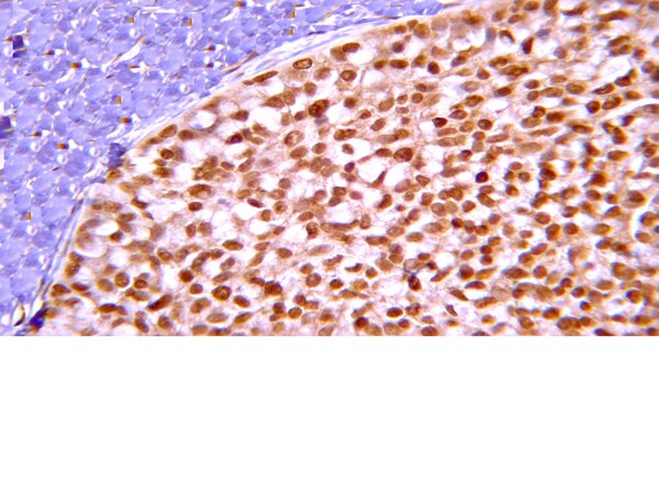 Anti-ARF1 Antibody, clone 3F1 | 05-1427